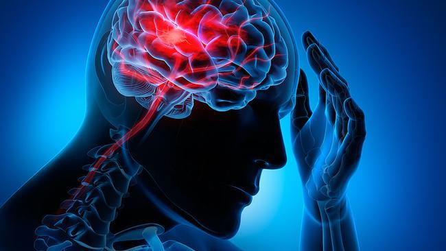 Schädel-Hirn-Trauma (SHT) » Symptome, Folgen & Therapie | MeinMed.at