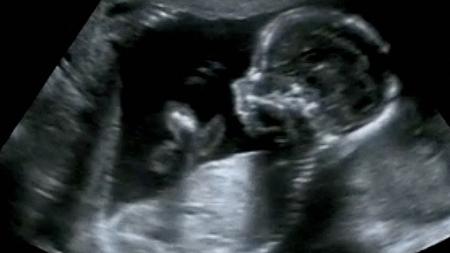 Sonographie » Verschiedene Ultraschallarten | MeinMed.at