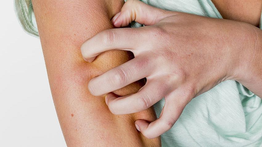 Kratzen bei Juckreiz » Warum juckt es und was hilft? | MeinMed.at