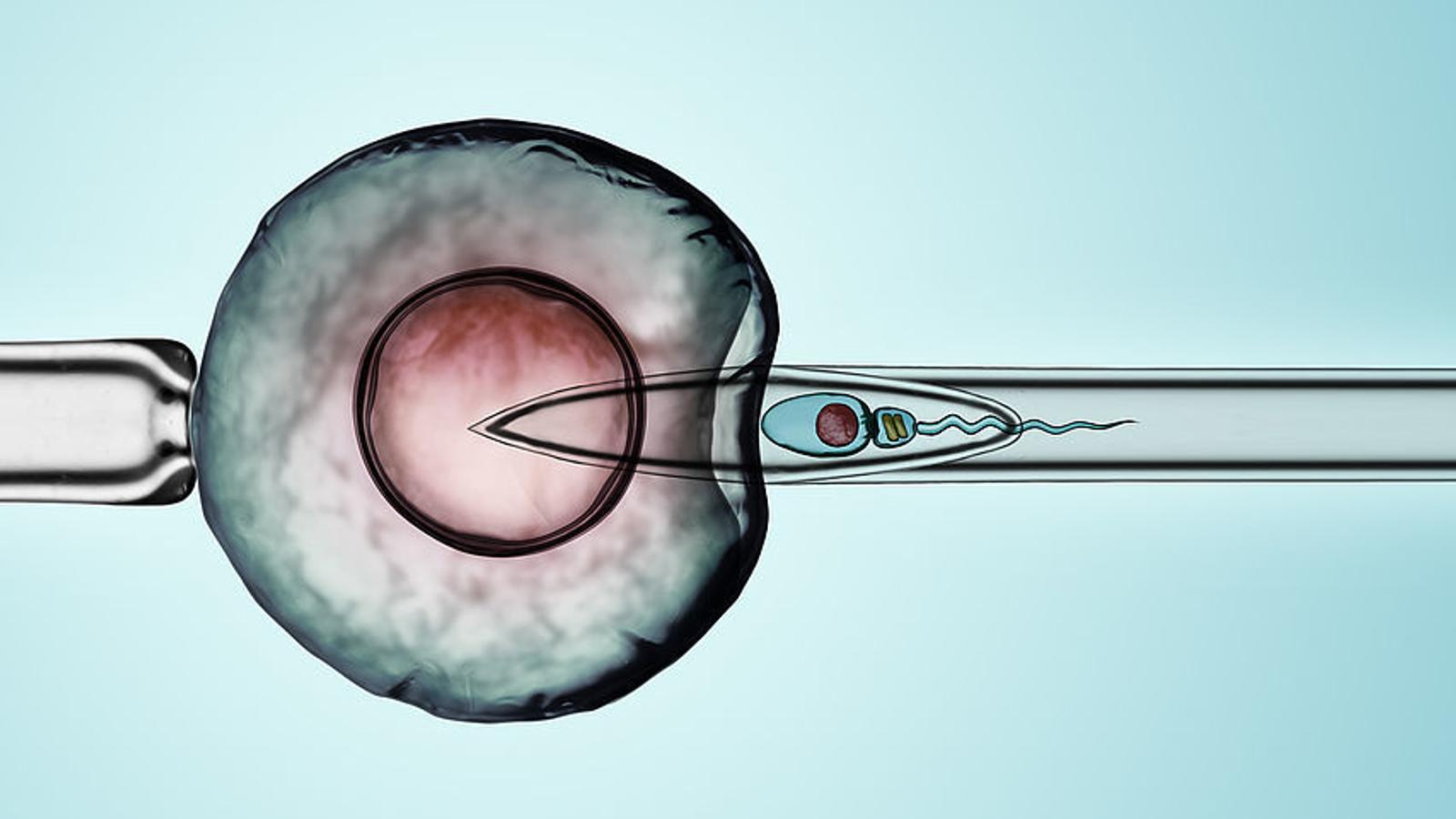 Künstliche Befruchtung Österreich » Wunschkinder durch IVF | MeinMed.at