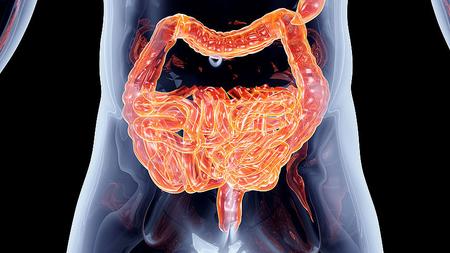 Gesunder Darm » Joghurt & Co. für die Darmflora | MeinMed.at