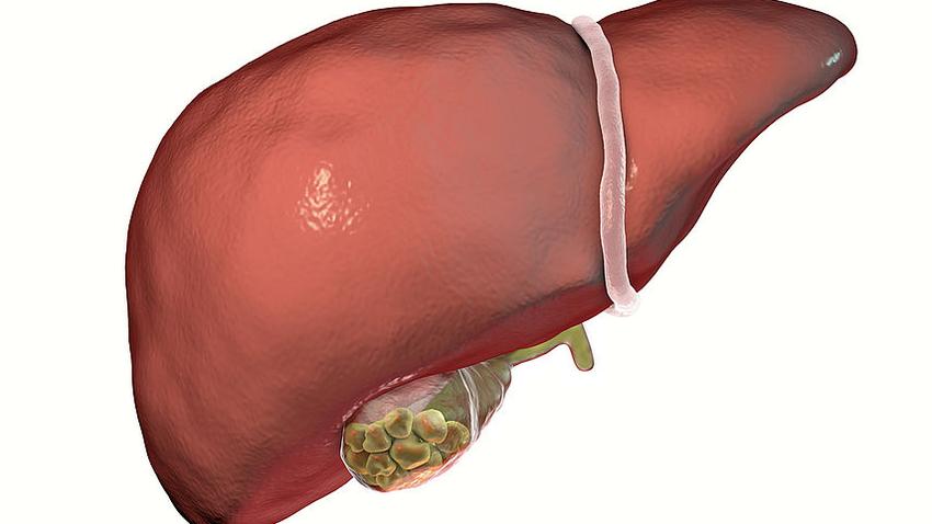 Gallensteine » Symptome, Entstehung, Diagnose & Behandlung | MeinMed.at