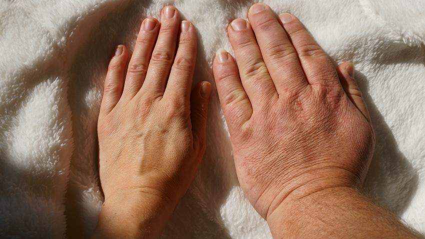 Akromegalie » Definition, Ursache & Behandlung | MeinMed.at